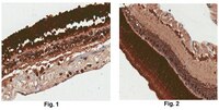 Anti-Recoverin Antibody | AB5585-I